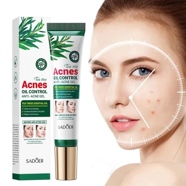 SADOER Tea Tree Acne Oil Control Face Gel Anti-Acne Hydrating Moisturizing Gel 20g | Daraz.com.bd