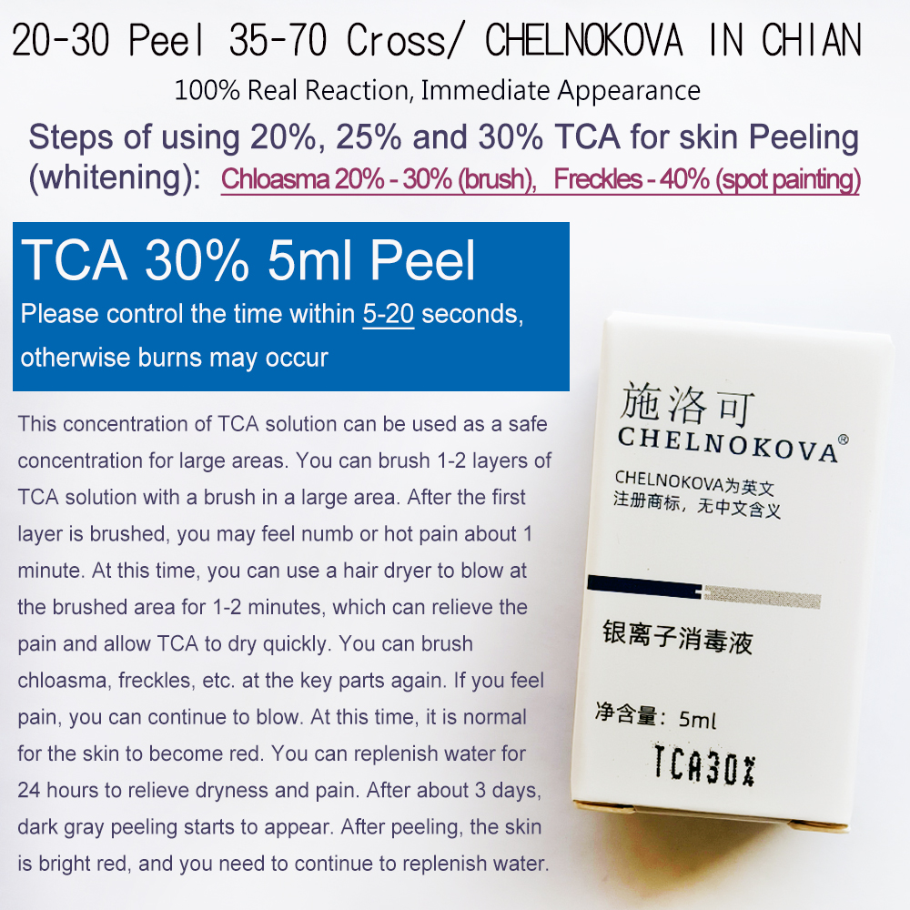 TCA 20% 30% 35% 40% 50% 60% 70% Pure TCA Peel Solution for Sun Damage ...