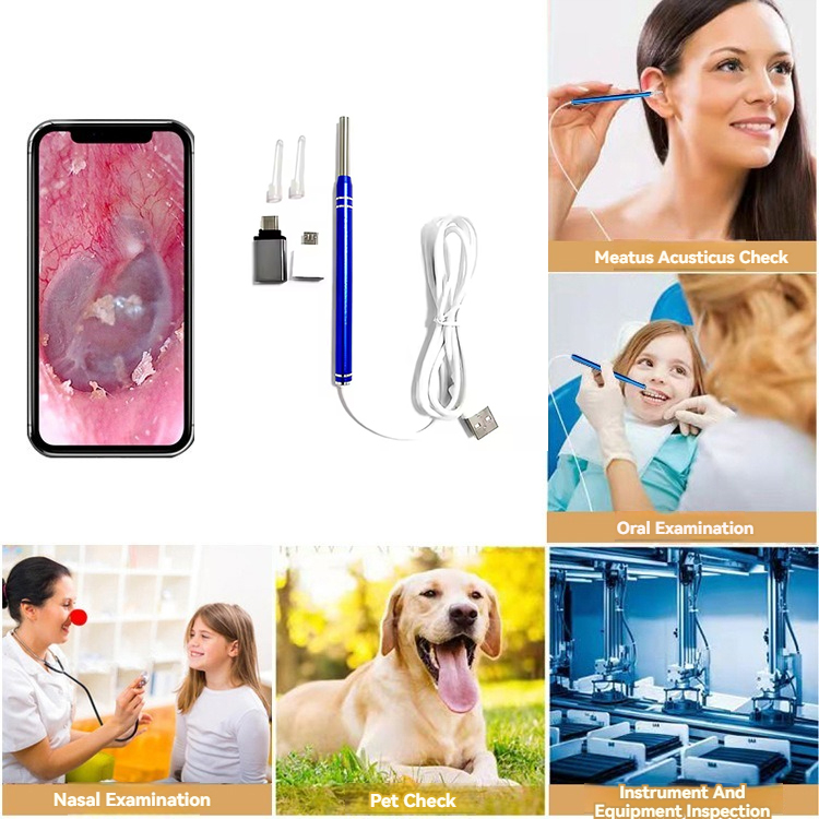HD Visual Ear Scoop Endoscope 4.5mm 500W Mini Camera Earwax Pick Ear ...
