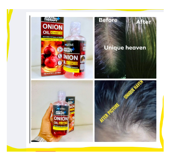 Positive Root Therapy Onion Oil | Daraz.com.bd