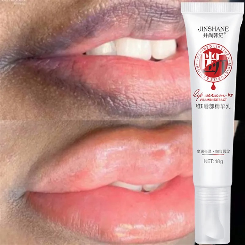 2024 New Lips Pink Cream Fresh Bleaching Treatment Remove Dark Smoke ...