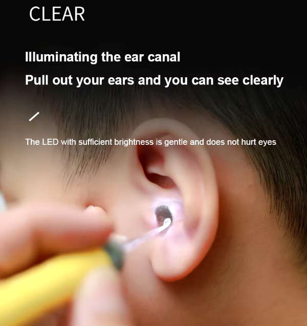 BABY EAR WAX CLEANING TOOLS SET [QAZV:85] (Hearing Aid Ear Care Tools)