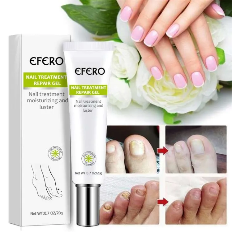 Efero Nail Repair Treatment Gel Fungus Cream-20gm | Daraz.com.bd