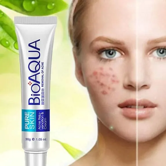 BIOAQUA Pure Skin Acne Rejuvenation & Cream - 30g | Daraz.com.bd
