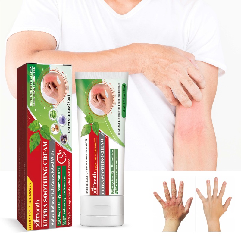 Skin anti itching cream relieve mosquito bites prickly heat red itchy ...
