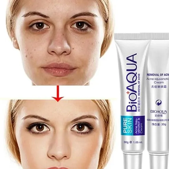 BIOAQUA Pure Skin Acne Rejuvenation & Cream - 30g | Daraz.com.bd
