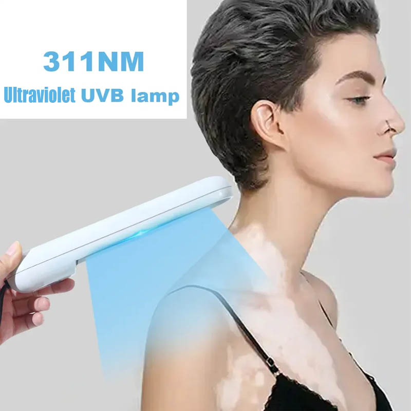 311nm UVB Lamp Ultraviolet Phototherapy Instrument for the Treatment of ...