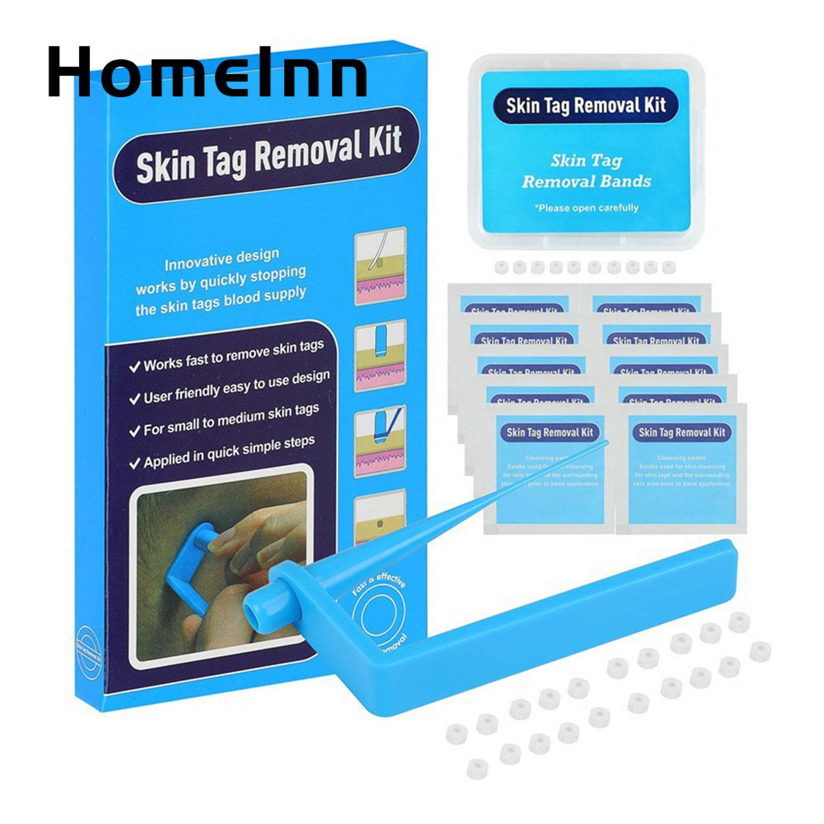 Remove Mole Tool Innovative Design Remove Mole Skin Tag Remover Tool ...