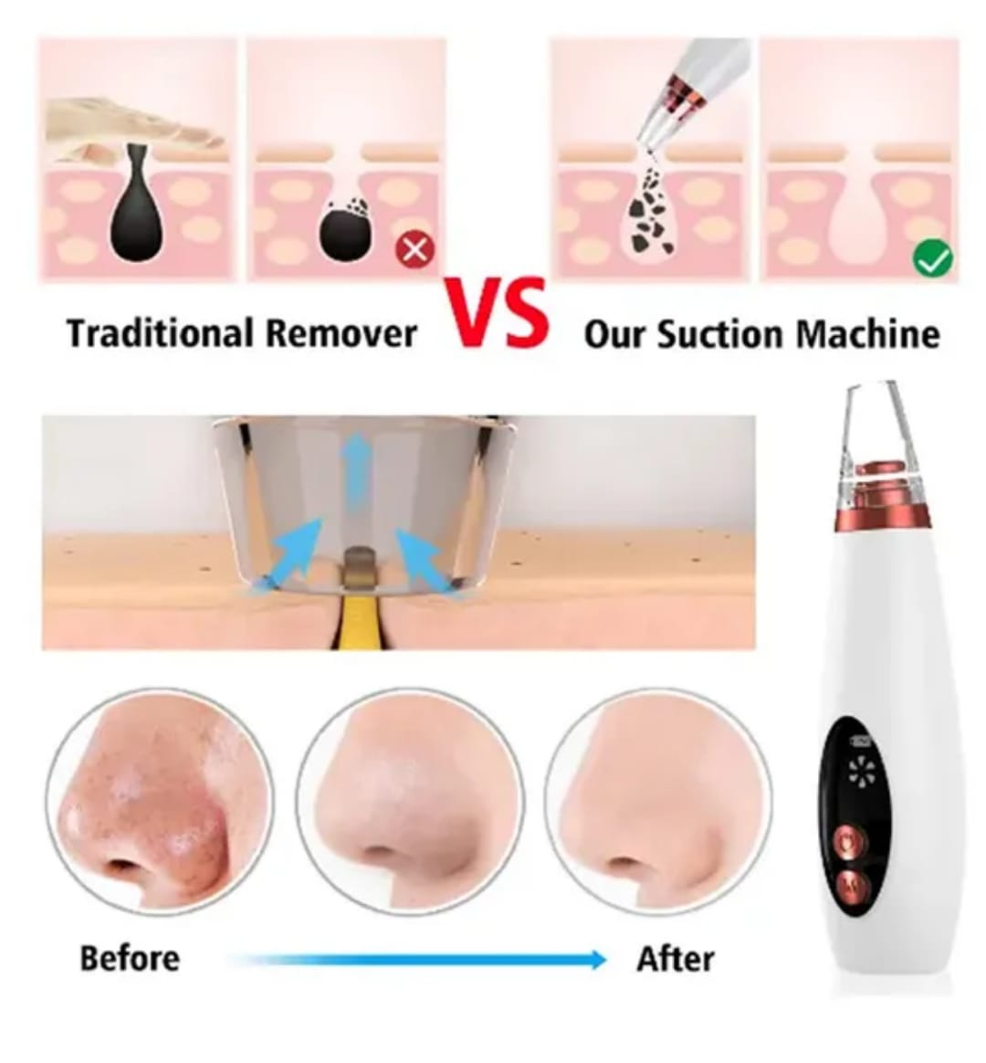 Electric Face Suction Removal Machine Pore Cleaner, blackhead ...