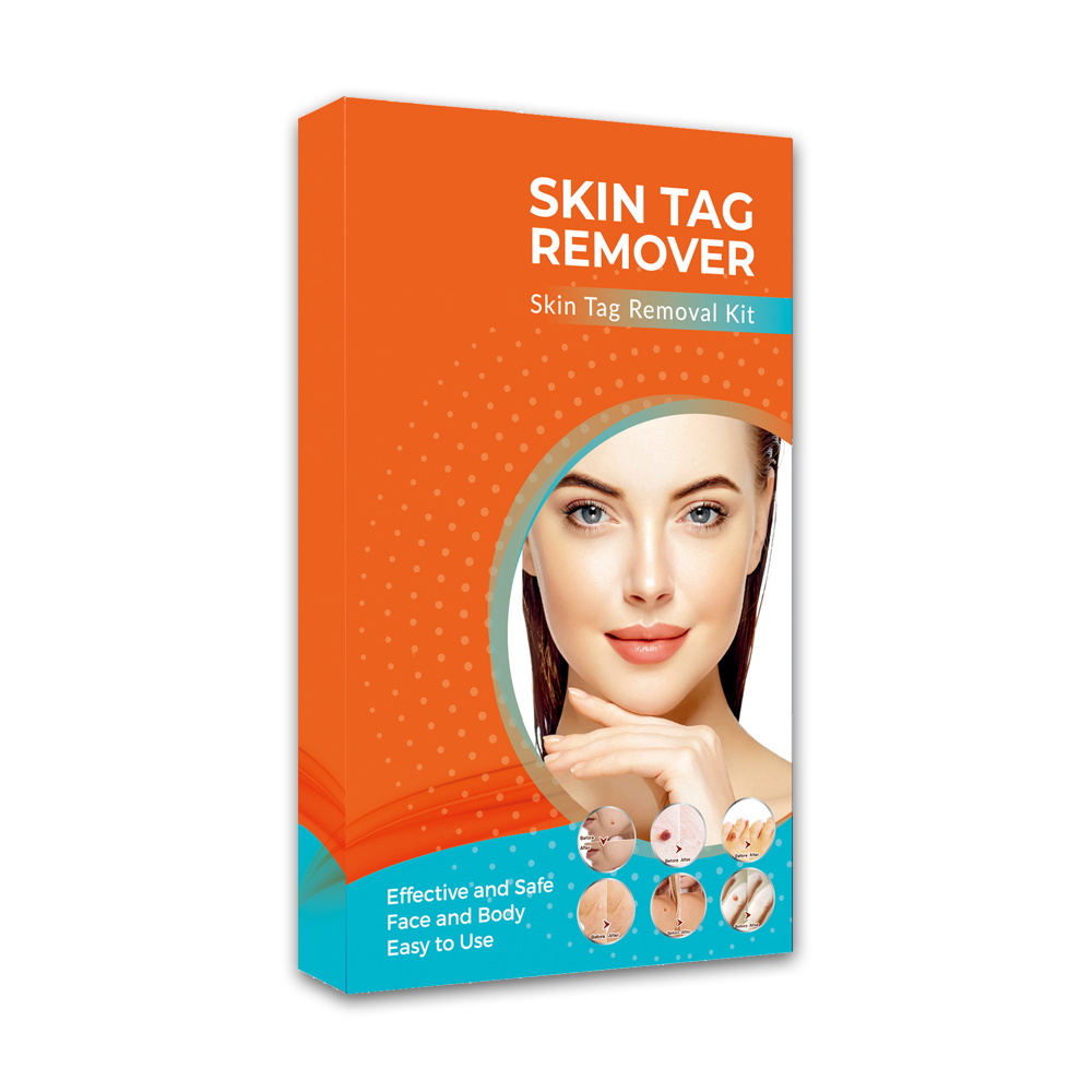 Painless Skin Tag Remove Device Kit Micro Tags Sized (2mm to 4mm) Warts ...