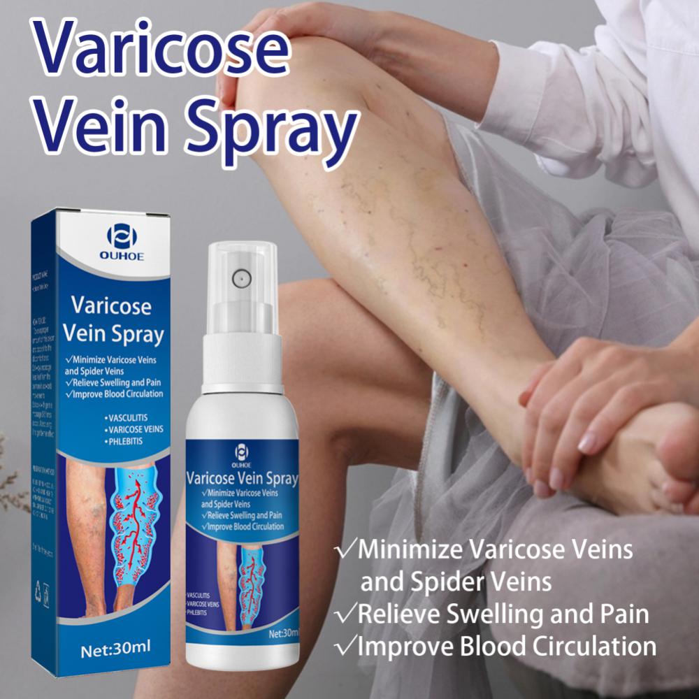 Varicose Veins Spray Medicine Spider Veins Relief Vasculitis Phlebitis ...