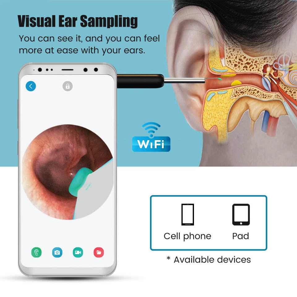 Bright, Clear, and Gentle – Smart Visual Ear Cleaner with HD Camera ...
