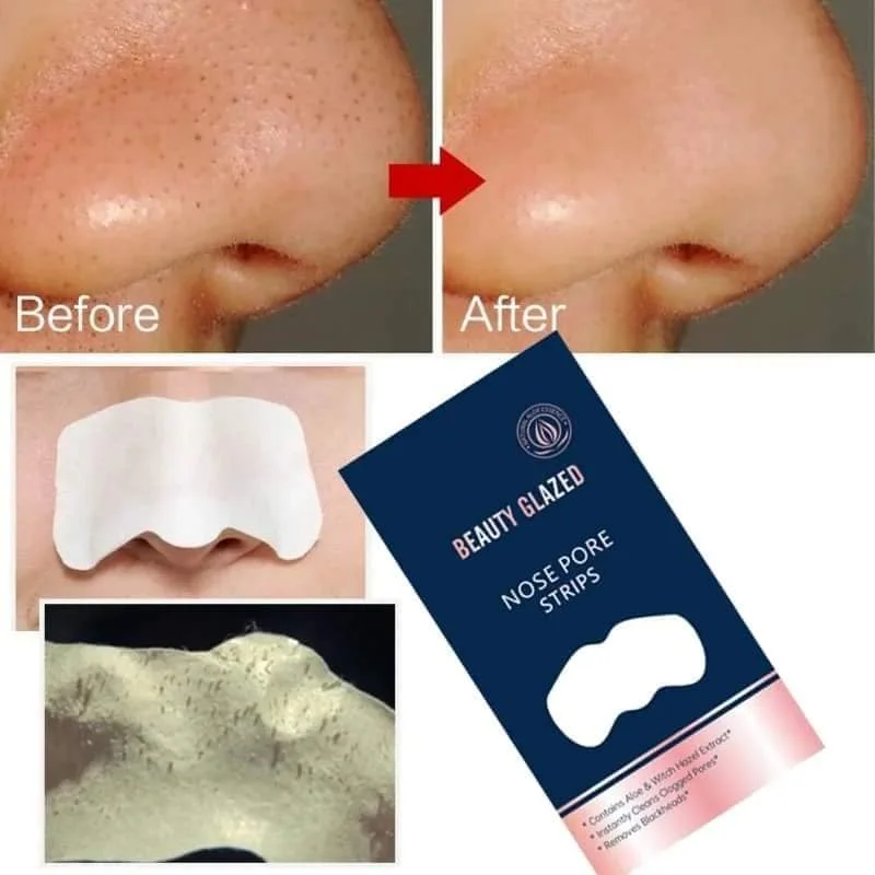 Beauty Glazed Nose Pore Strips Blackhead Acne Nose Patch To Remove Skin ...