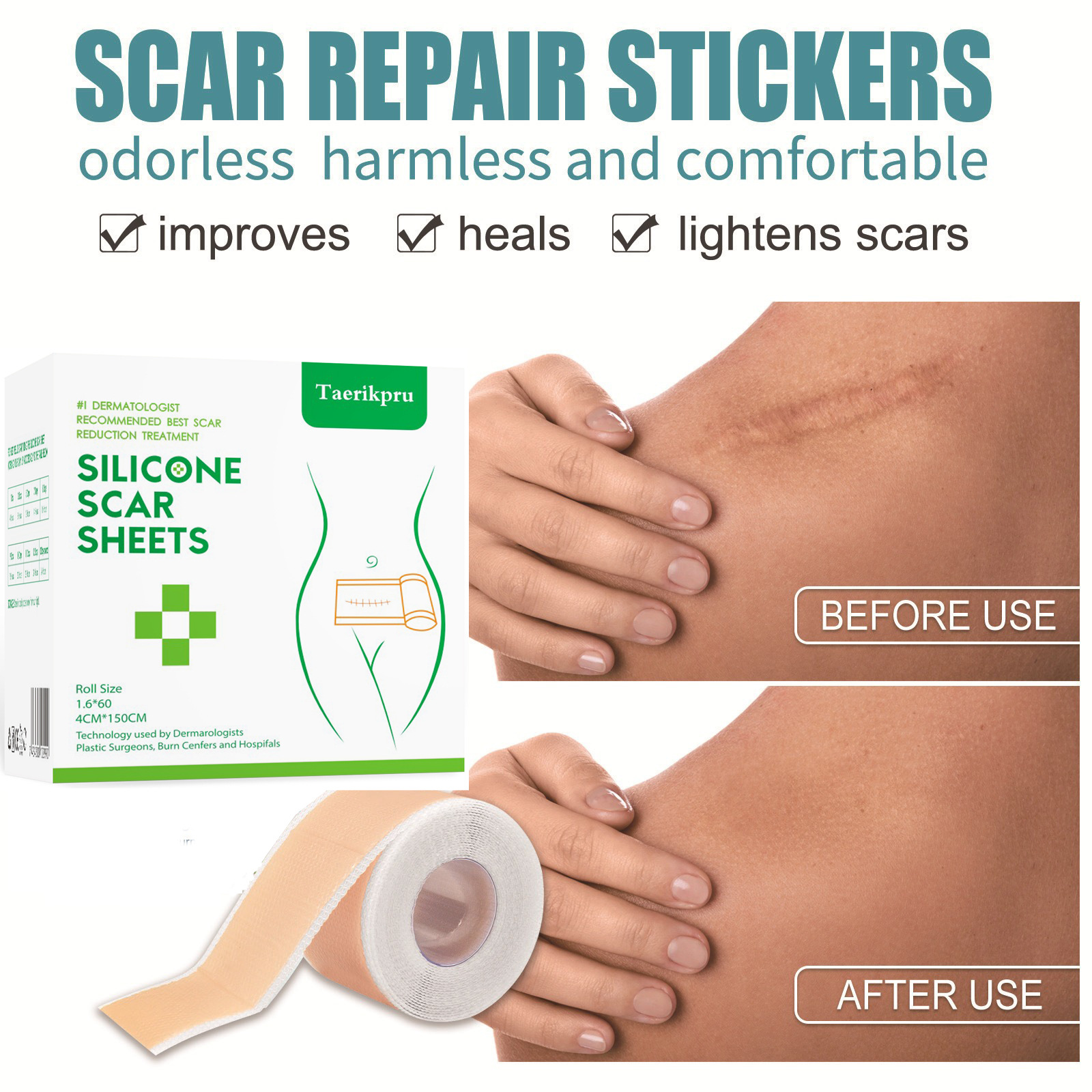 Silica Gel Wound Scar Sticker Roll Waterproof Fade Pregnancy Tattoo ...