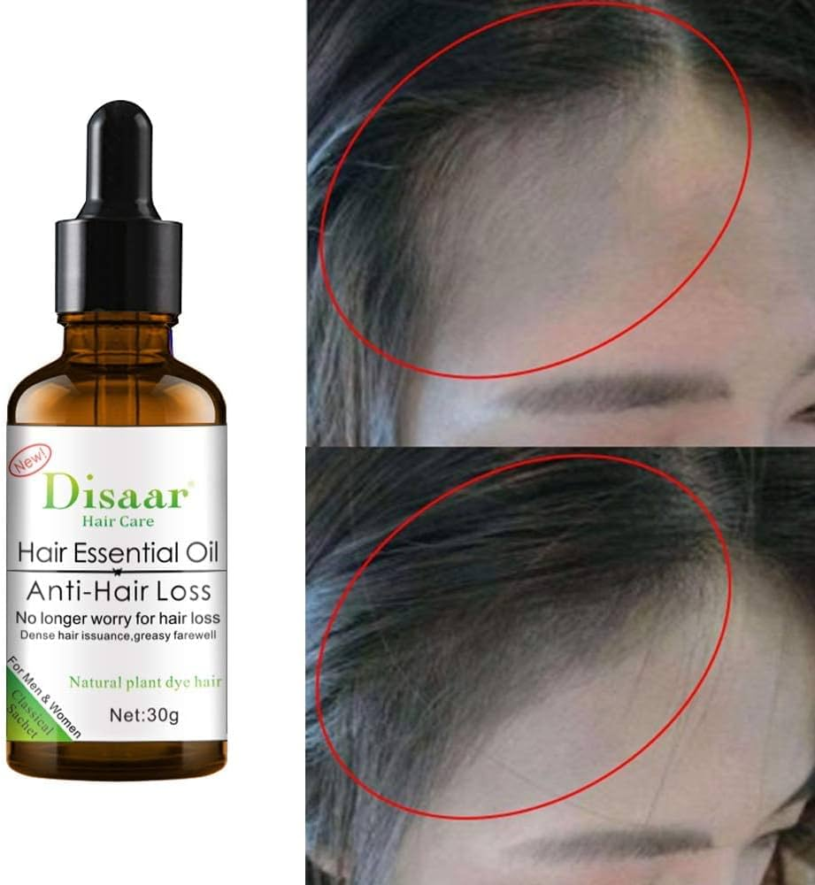 Disaar Anti Hair Loss Treatment Fast Thicker Increase Hair Regrowth ...