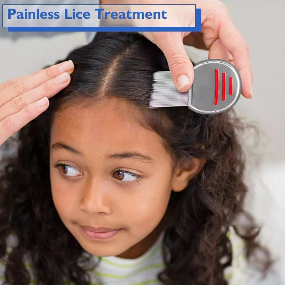Lice and Nit Egg Free Treatment Professional Stainless Steel Lice ...