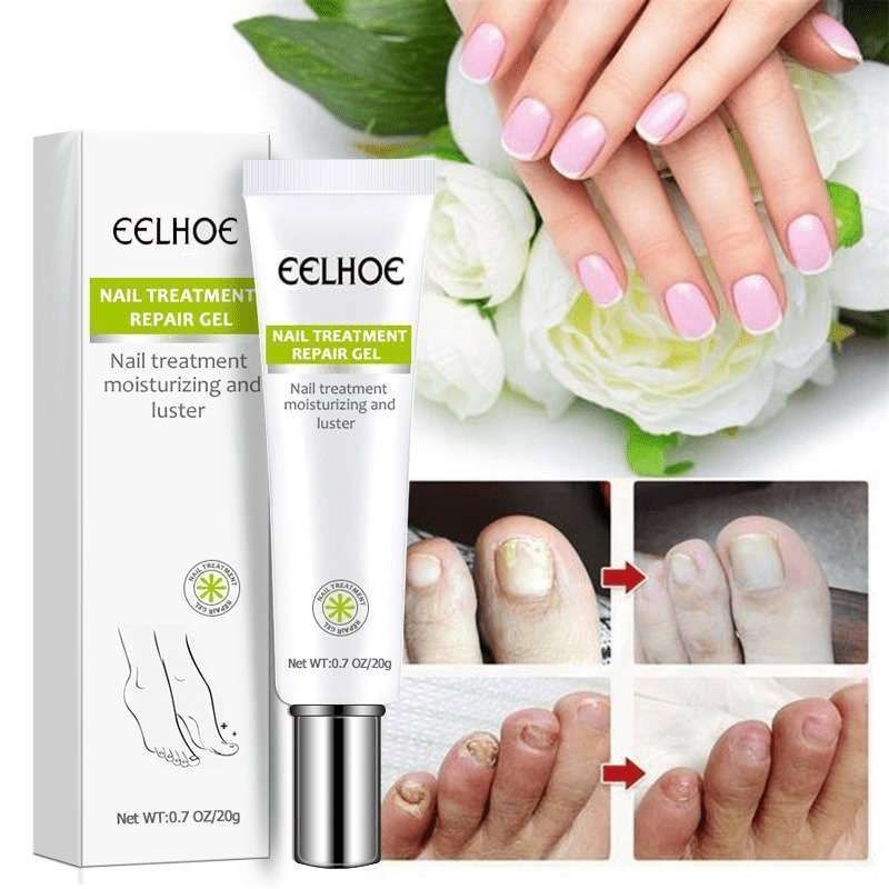 Nail Repair Gel Fungus Treatment Solution Anti fungal Removal Infection ...
