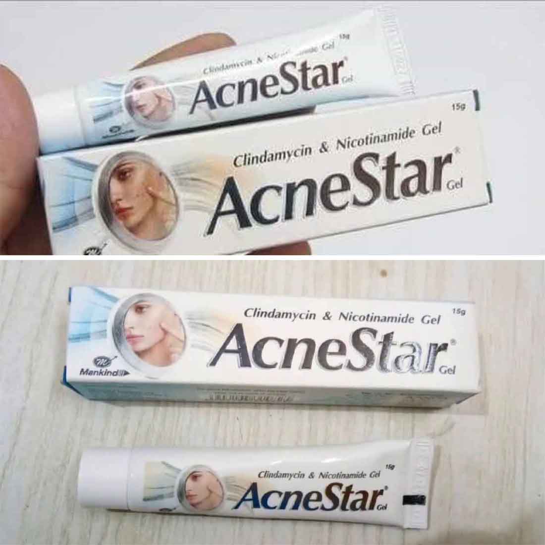 AcneStar Gel Cream For pimples - 15 gm