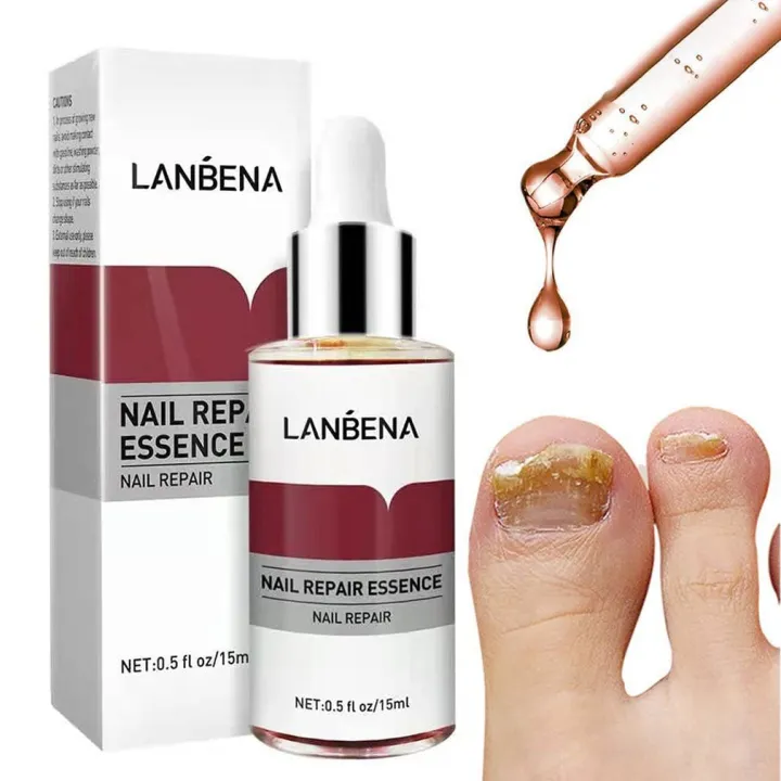 LANBENA Nail Repair Essence - 15 ml (OA)