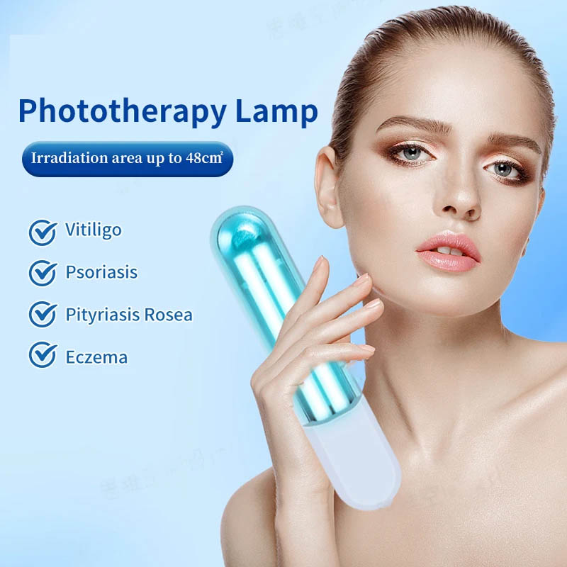 311nm UVB Lamp Ultraviolet Phototherapy Instrument for the Treatment of ...